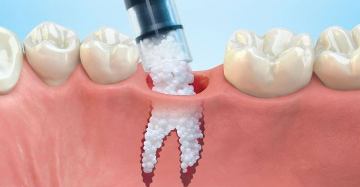 Top notch Dental Care Services In White Plain & Riverdale